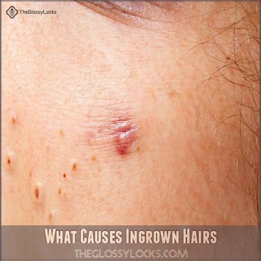 Avoid Ingrown Hairs After Shaving: 7 Expert Tips for Smooth, Bump-Free Skin