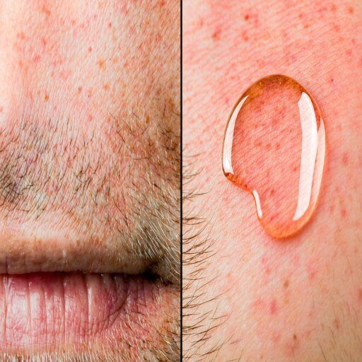 How to Shave a Coarse Beard Without Razor Bumps: Easy Tips for Smooth Skin