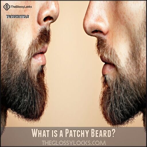 Patchy Beard Styles: 10 Jaw-Dropping Looks That Will Turn Heads in 2025