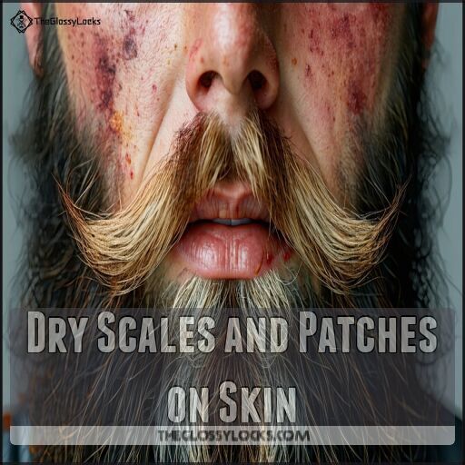Beard Health: 7 Solutions to Stop Itchy Skin That Dermatologists Swear By