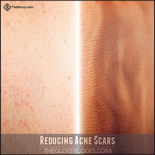 Effective Acne Treatment for Oily Skin: 8 Must-Try Products in 2025