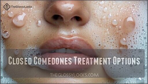 Acne Treatment for Closed Comedones: 10 Game-Changing Solutions That Work