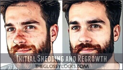 Minoxidil Beard Growth Results: Before & After Guide (2025)