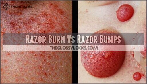 Razor Bumps Vs Razor Burn: Key Differences, Causes, and Prevention Tips