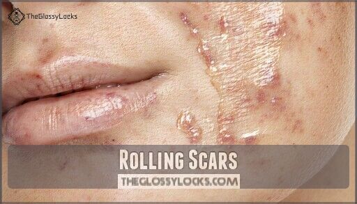 Best Acne Scar Removal Cream: 10 Top Products That Actually Work