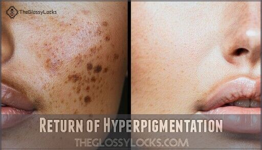 What Happens When You Stop Using Hydroquinone Cream: Rebound Effects